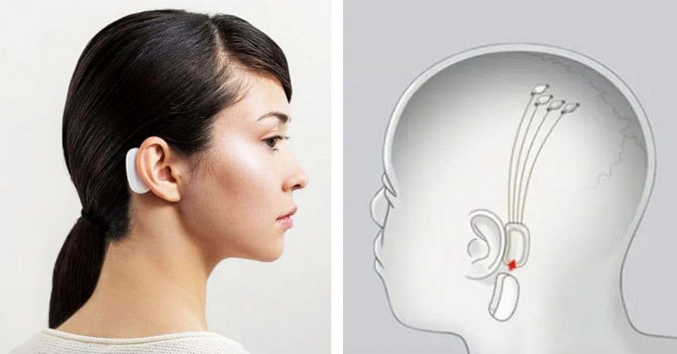 What Is Neuralink And How Does It Work