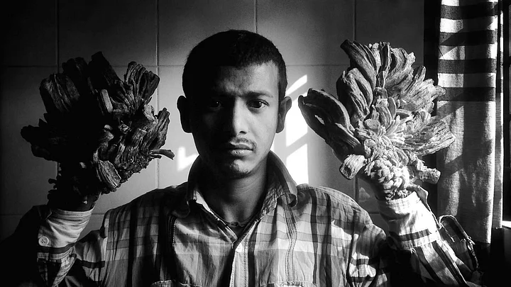 Bangladeshs ‘tree Man Abul Bajandar Back In Hospital