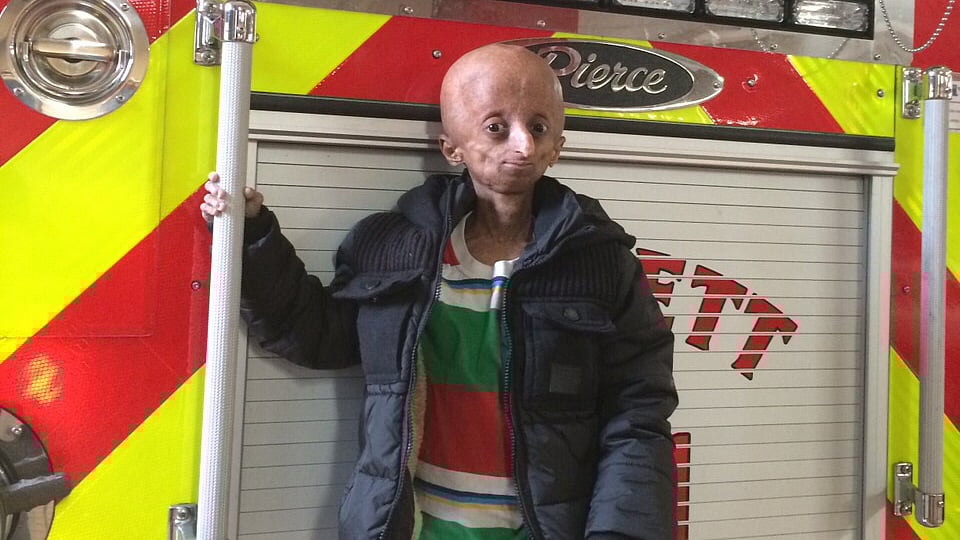 A New Drug Could Help The First Indian Kid With Progeria