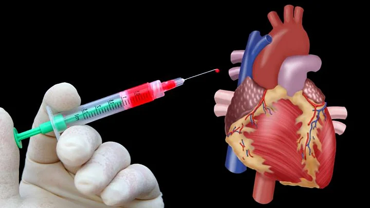 Complex Surgery Saves Life of Man With Hugely-Swollen Artery