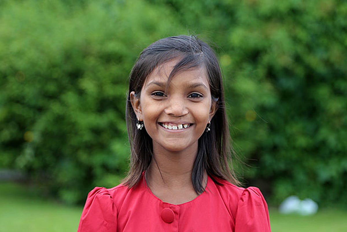 Smile Train is Curing Kids With Cleft Lips: One Even has an Oscar!