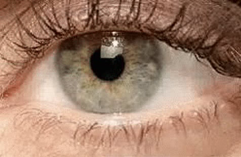 Why Does My Eye Twitch and How Do I Make It Stop?