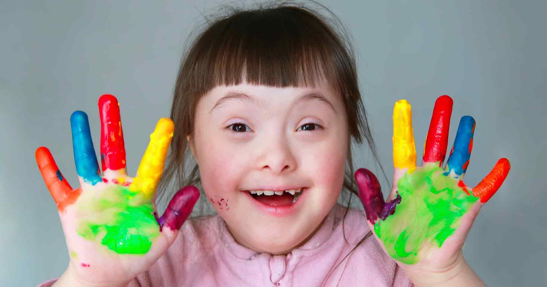 World Down Syndrome Day 2019 What Is Down s Syndrome Causes Of Down s world-down-syndrome-day-2019-what-is-down-s-syndrome-causes-of-down-s