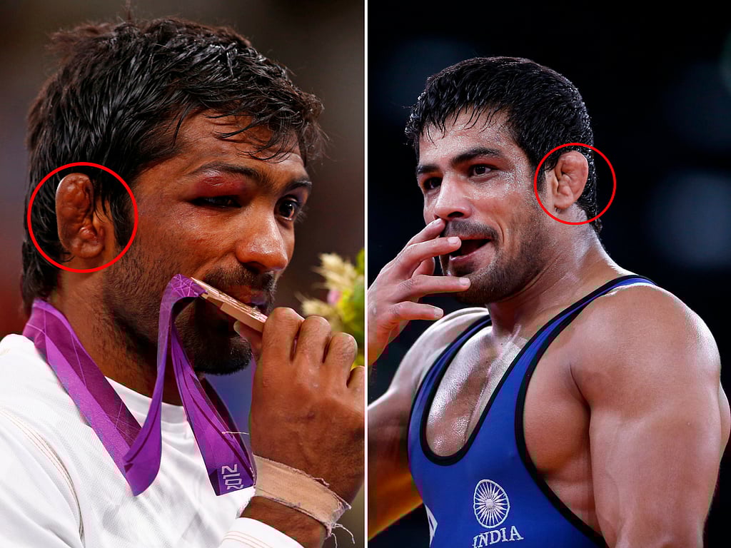 Wrestlers Around the World Have Weird Ears, Ever Wondered Why?