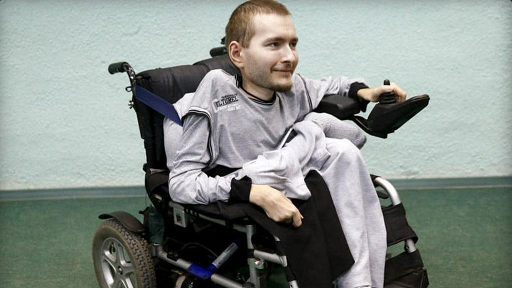 The Bizarre Plan for World’s First Human Head Transplant