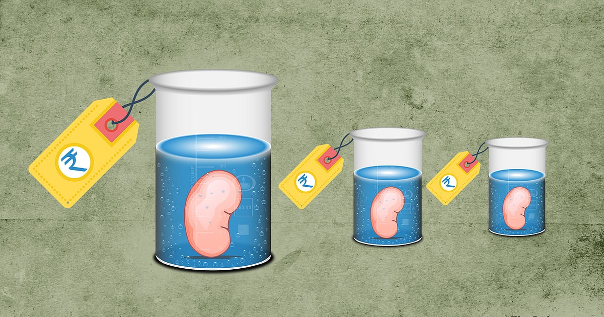 Prominent Netas, Businessmen Under Lens in Kidney Racket Case