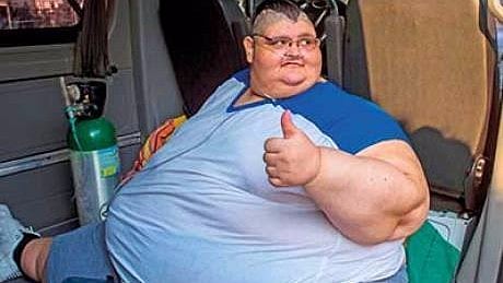 World’s Heaviest Man Successfully Undergoes Surgery in Mexico