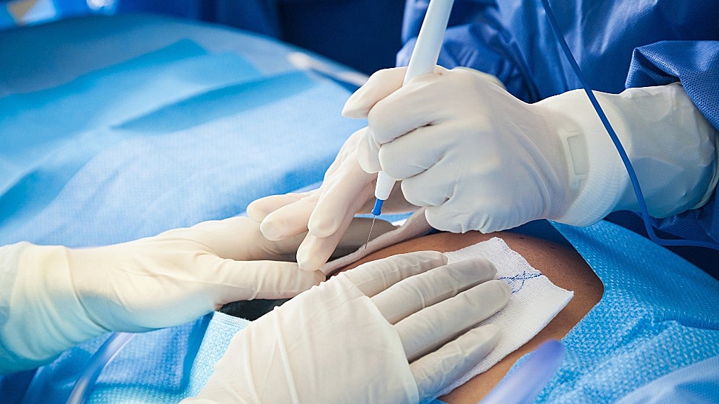 World’s First Heart Surgery Inside the Womb Performed in Canada