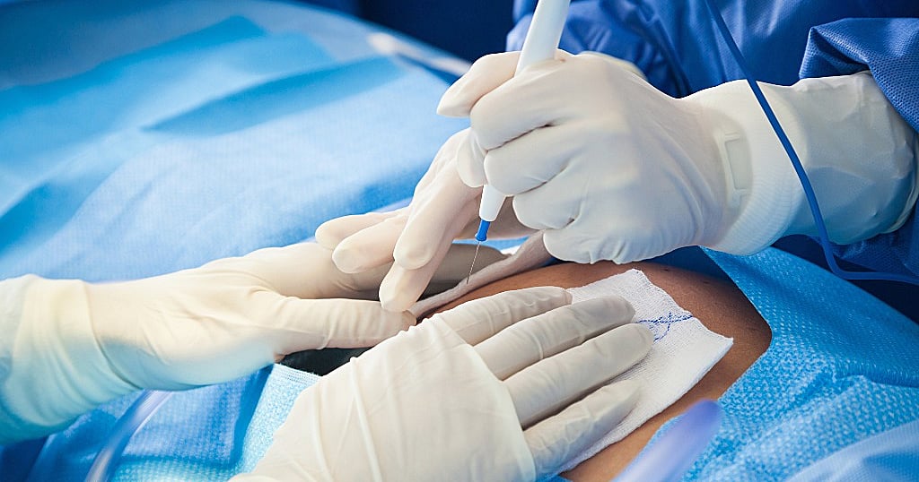 World’s First Heart Surgery Inside the Womb Performed in Canada