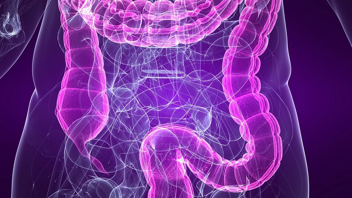 Leaky Gut Syndrome: Causes, Symptoms, Diagnosis, and Prevention