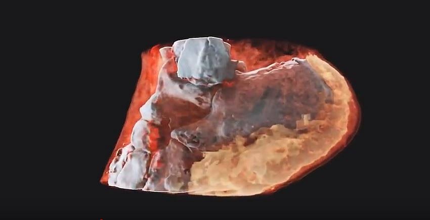 Coloured X-Ray: New Zealand Company MARS Bioimaging Uses CERN ...