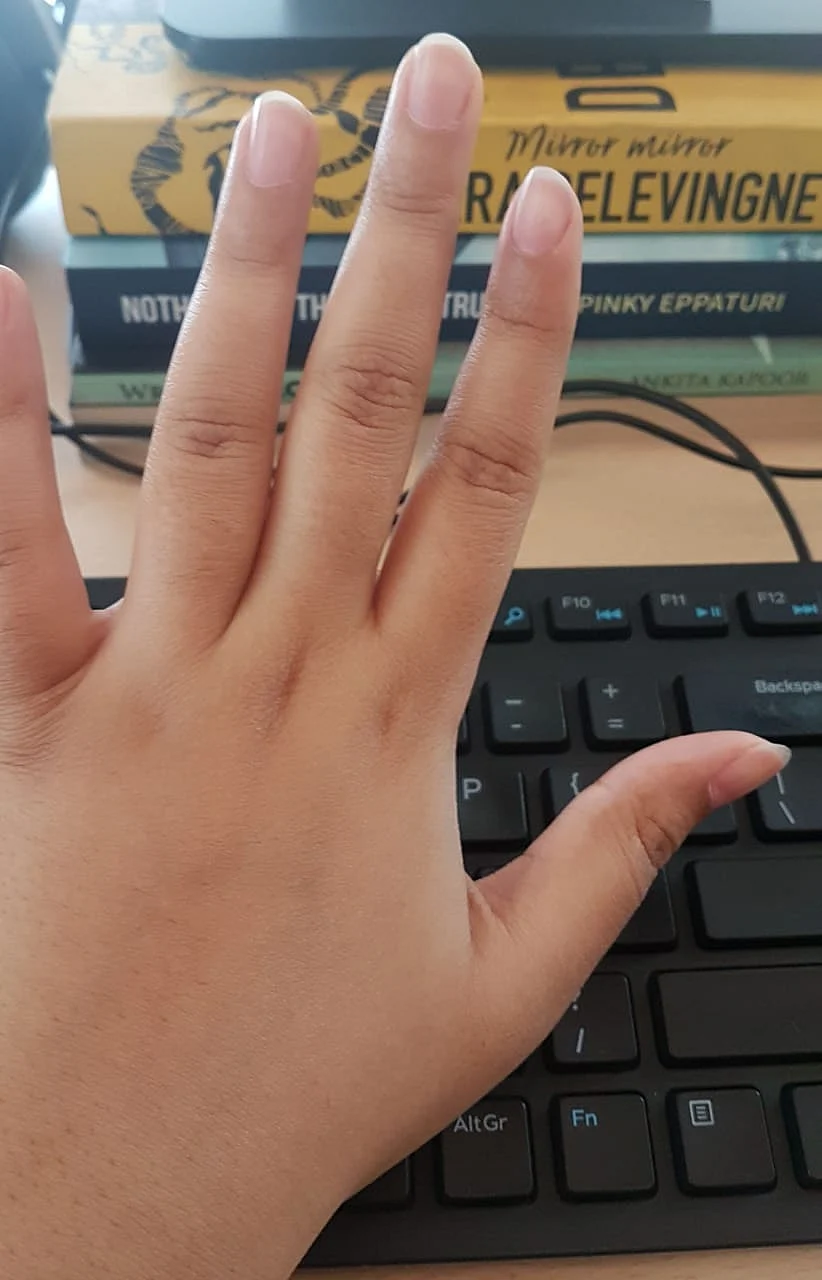 Election 2019 Phase 1 Voting: Voters Complain of Indelible Ink Washing Off