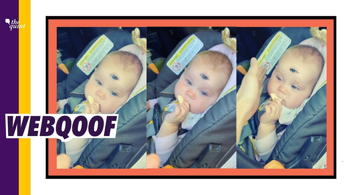 Human Born With Three Eyes