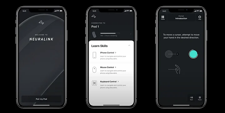 What is Neuralink & How Does It Work?