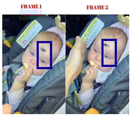 Human Born With Three Eyes