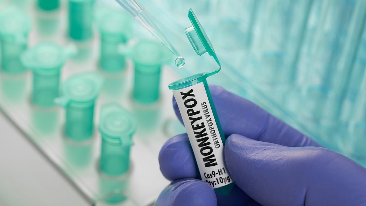 1st Cases of Monkeypox in Children in US: How Does It Spread?