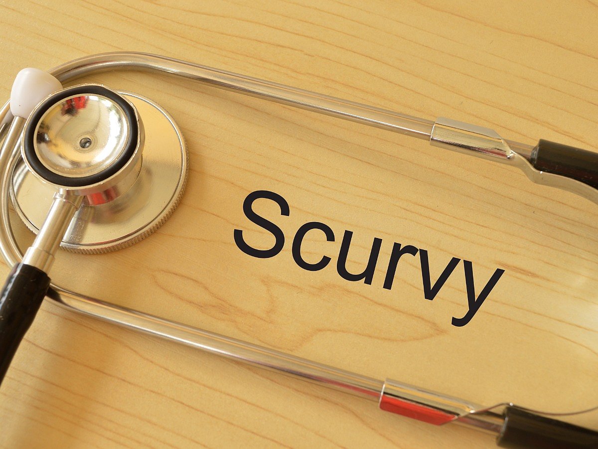 Scurvy: Symptoms, Causes, Diagnosis, and Treatment