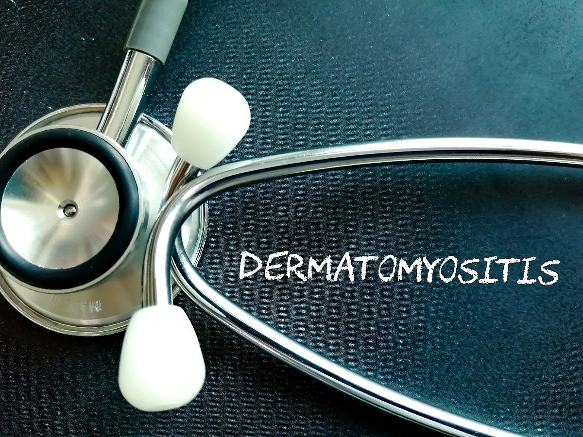 Dermatomyositis: Symptoms, Causes, Diagnosis, and Treatment