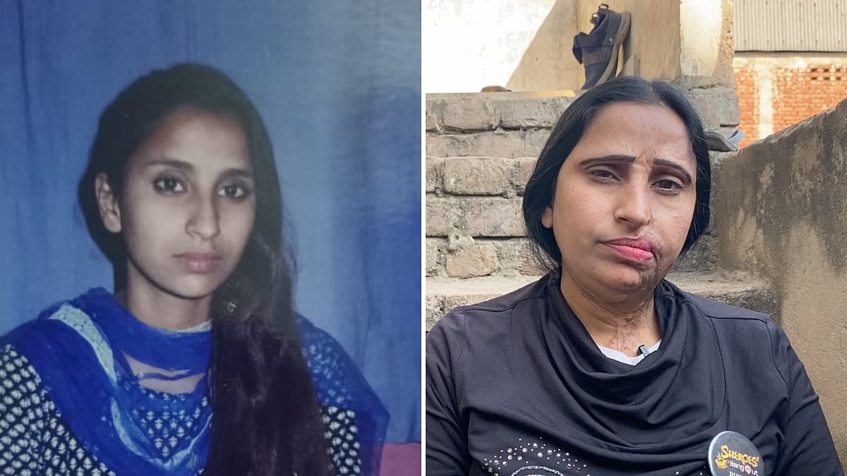 'Hope We Inspire Others': Why Two Acid Attack Survivors Filed FIRs ...
