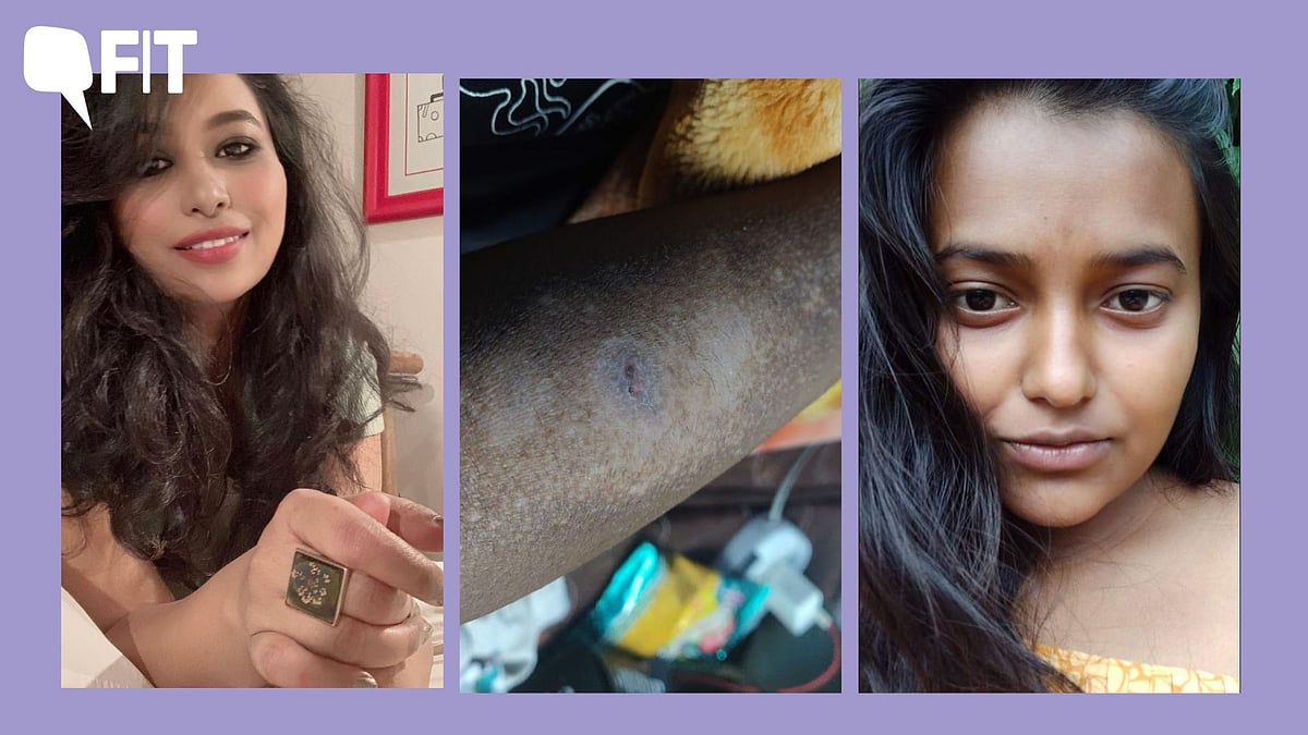 Skin Diseases & Mental Health: Severe Skin Conditions Can Cause Anxiety ...