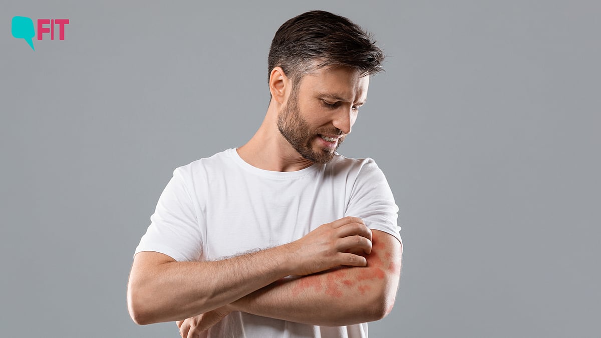 In Photos | Moonsoon & Moisture: Types of Fungal Infections That You ...