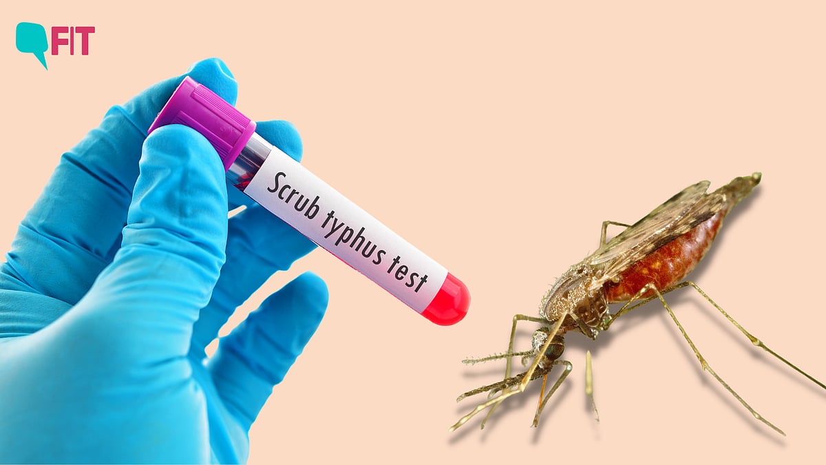 5 Scrub Typhus Deaths in Odisha, 9 in Shimla: What Is the Deadly Infection?