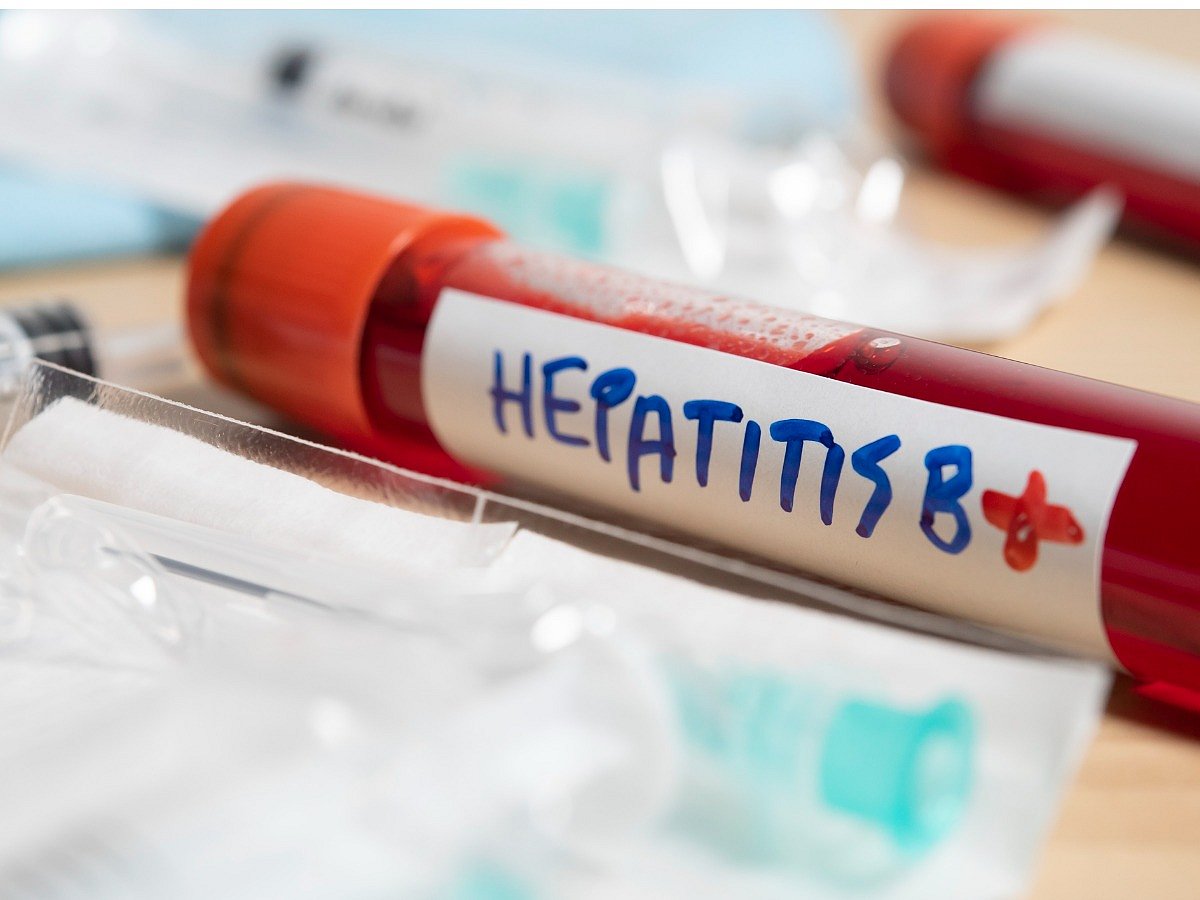10 Signs and Symptoms Of Hepatitis B