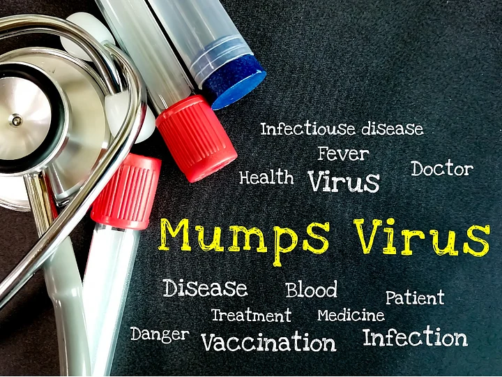 6 Tips To Prevent Mumps From Spreading