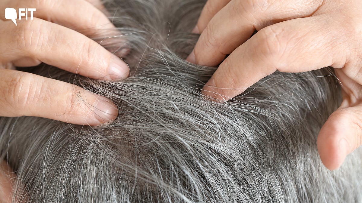 Youngsters Embracing Premature Grey Hair, but What Causes It? Can It Be ...